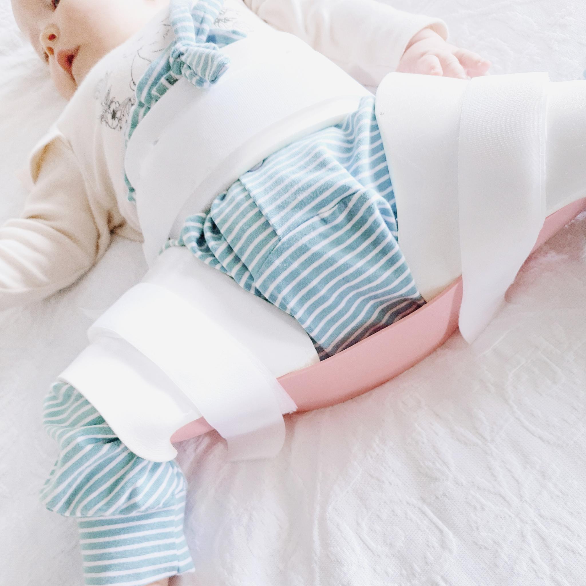 Developmental Dysplasia of the Hip in Children - Upside Kids Physio